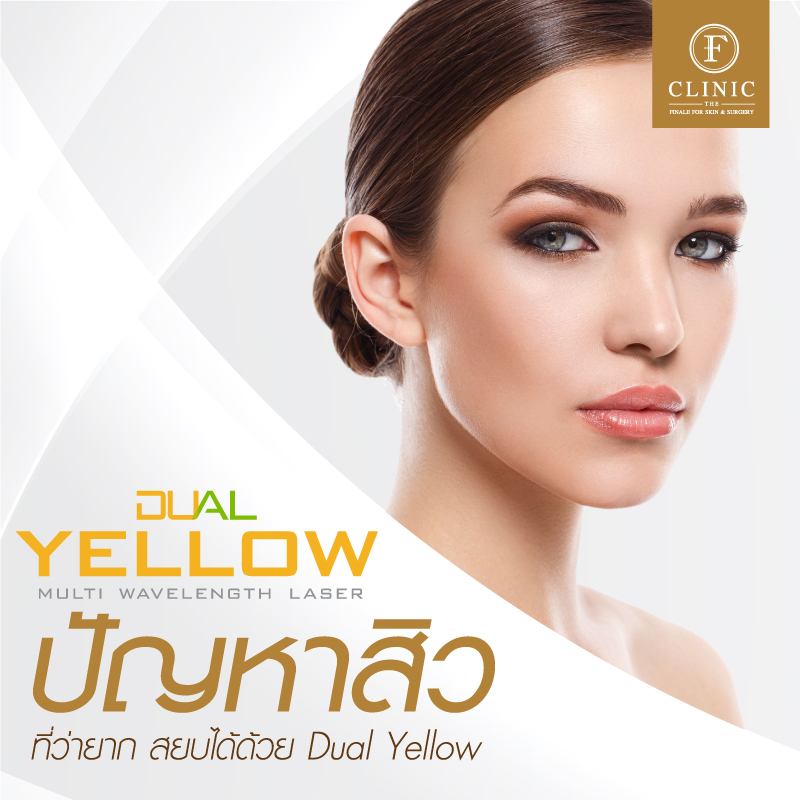 Dual Yellow เลเซอร์รักษาสิว ด้วยพลังงานแสง - F Clinic คลินิกความงาม ครบ ...